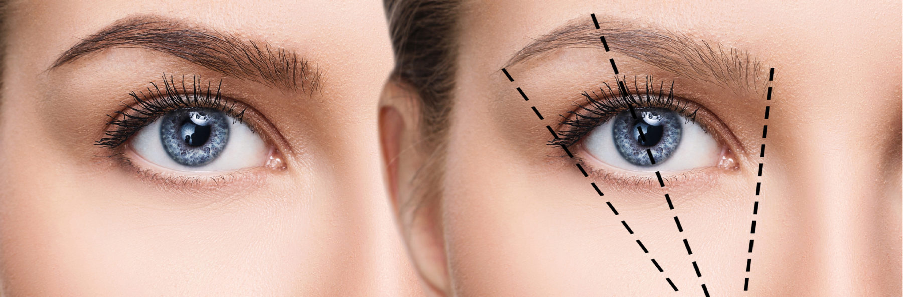 acne and acne scarring, ageing skin, anti-ageing and wellness, anti ...